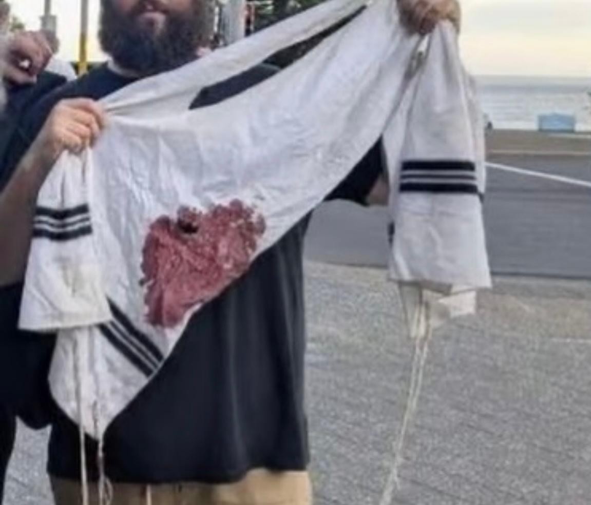 Blood in talith in hanuka masacre